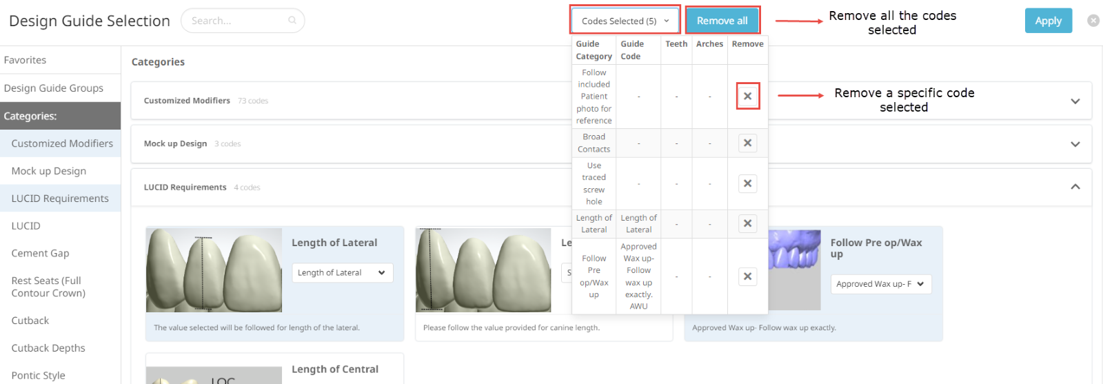3Shape Design Service Platform - How to Add Design Guide Codes when ...