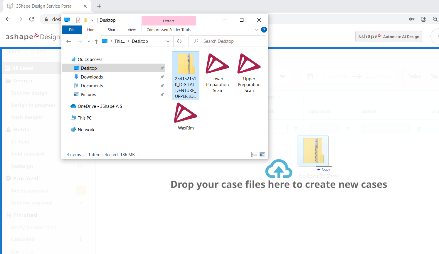 Dentures - Standard Denture Offering - Sending a Standard Denture Case ...