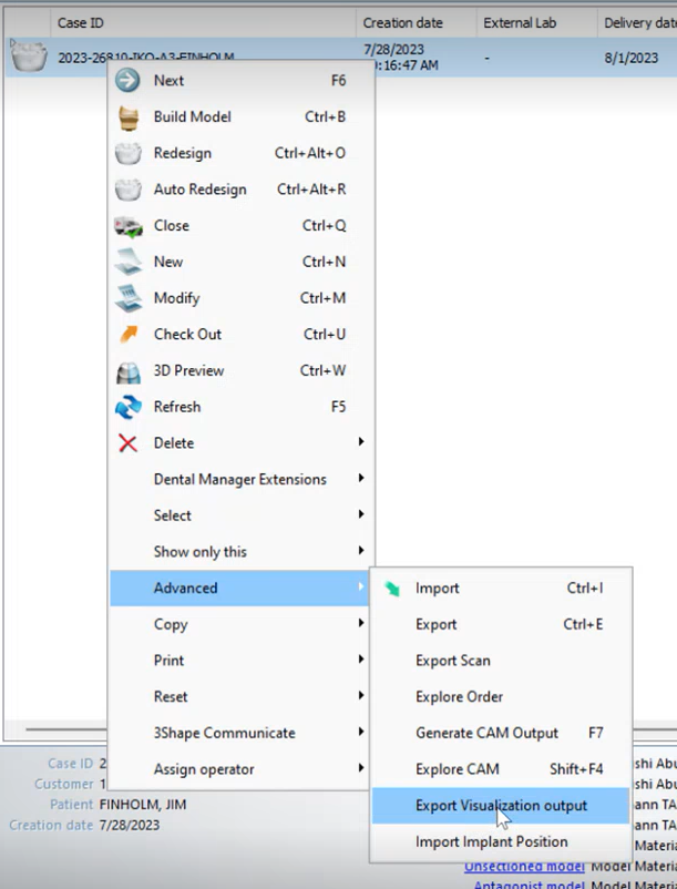 3shape Automate Visualization Output 3shape Design Services