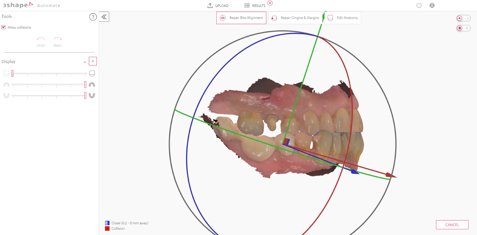 3Shape Automate – Online Editor Tool and 3D Viewer Overview – 3Shape Design Services