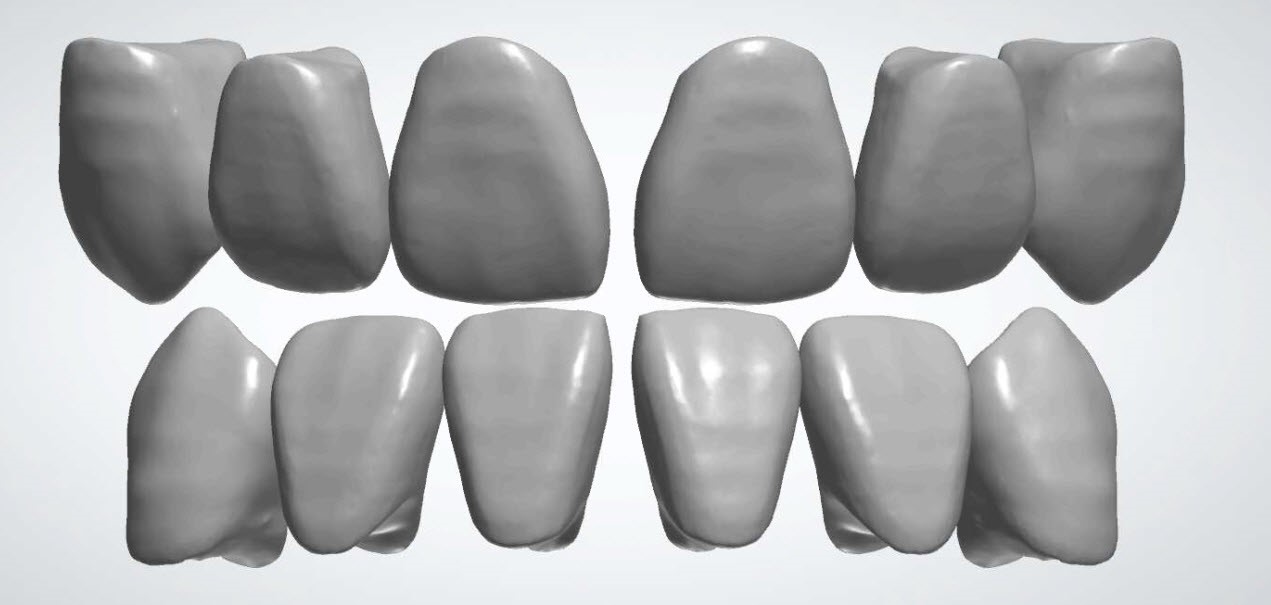 3Shape Dental System - Libraries – 3Shape Design Services