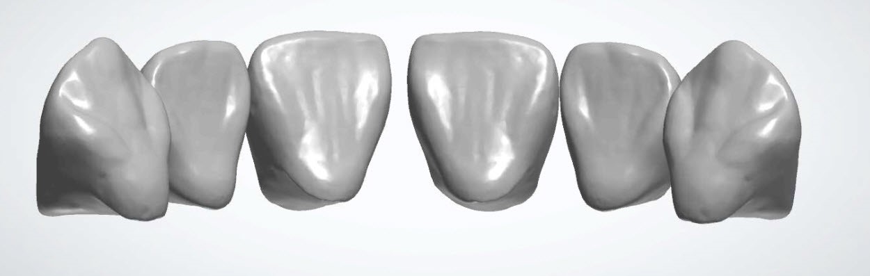 3Shape Dental System - Libraries – 3Shape Design Services
