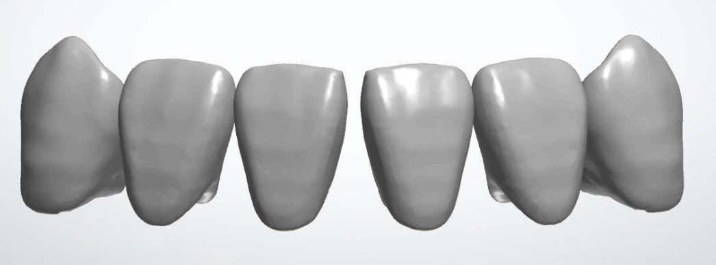 3Shape Dental System - Libraries – 3Shape Design Services