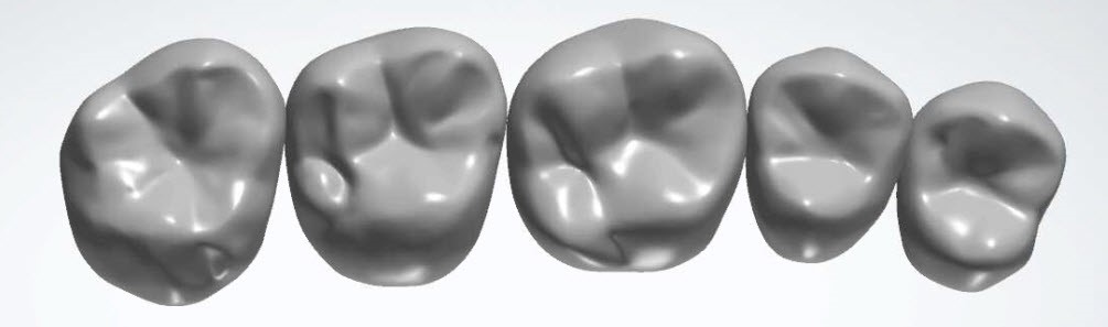 3Shape Dental System - Libraries – 3Shape Design Services