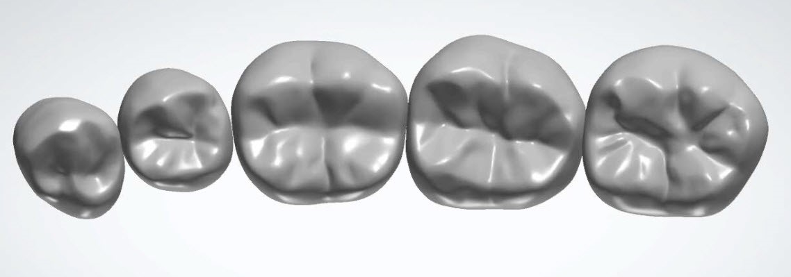 3Shape Dental System - Libraries – 3Shape Design Services