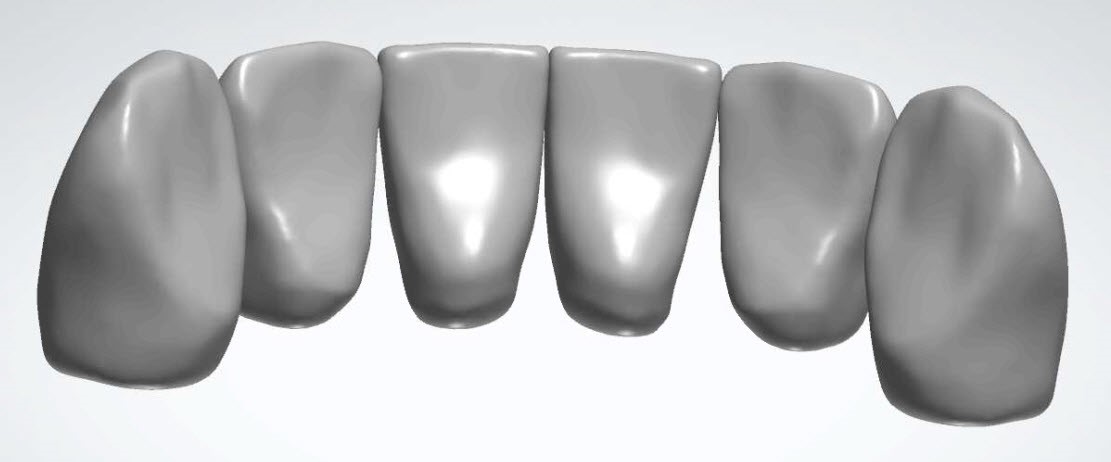 3Shape Dental System - Libraries – 3Shape Design Services