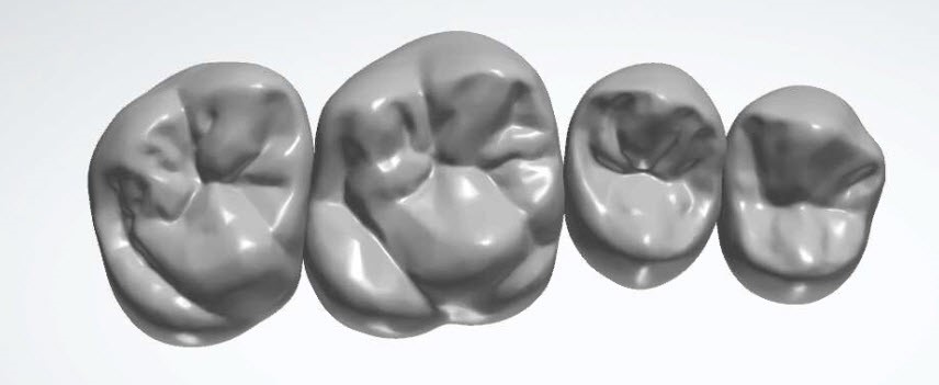 3Shape Dental System - Libraries – 3Shape Design Services