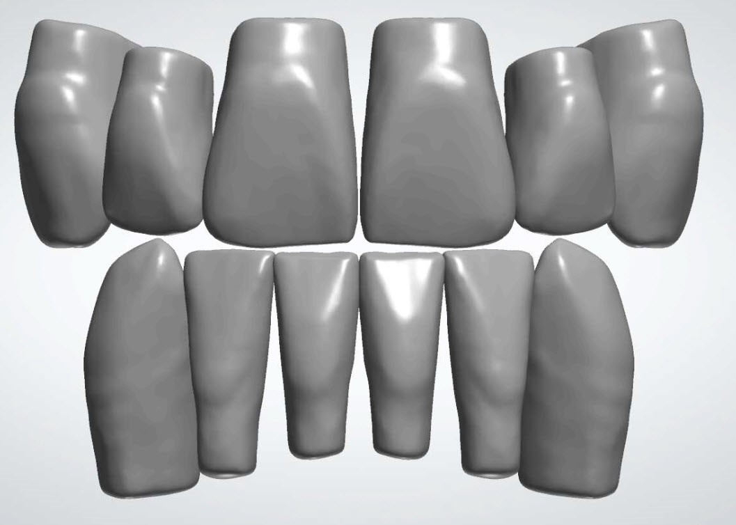 3Shape Dental System - Libraries – 3Shape Design Services