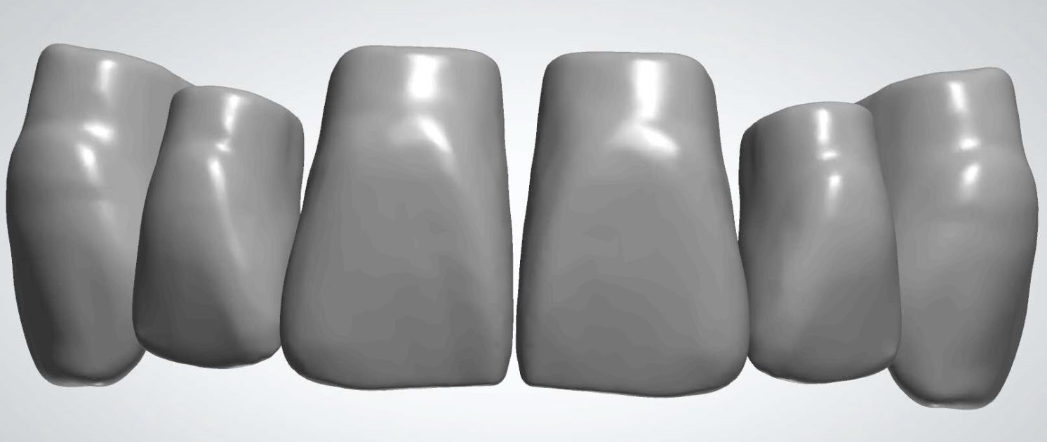 3Shape Dental System - Libraries – 3Shape Design Services