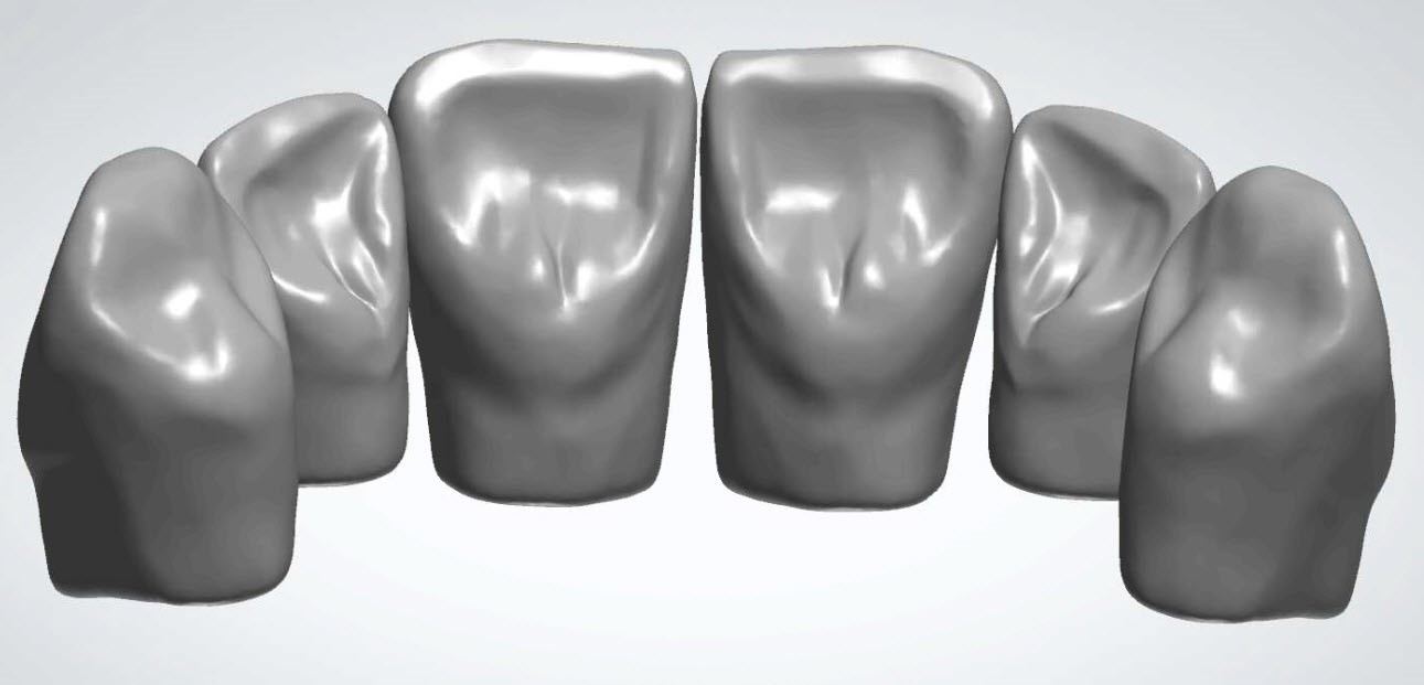 3Shape Dental System - Libraries – 3Shape Design Services