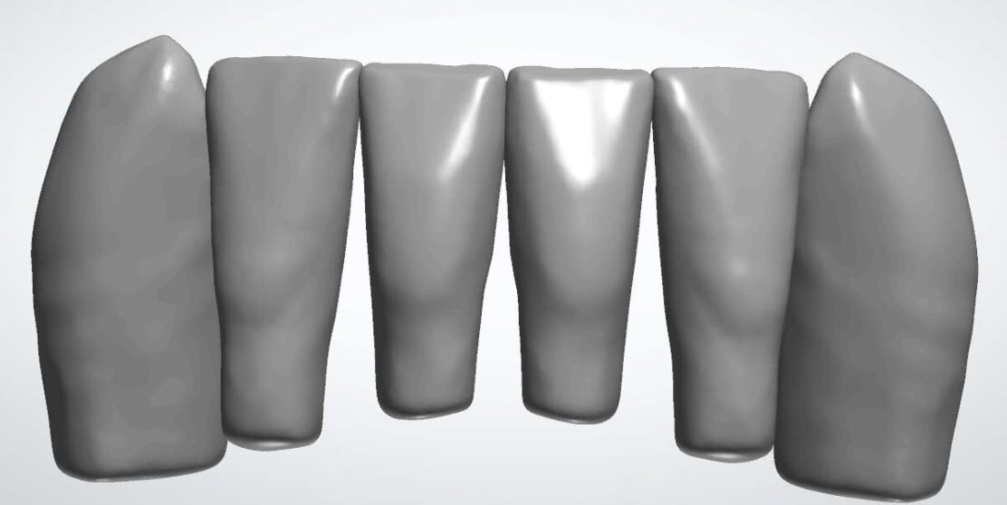 3Shape Dental System - Libraries – 3Shape Design Services