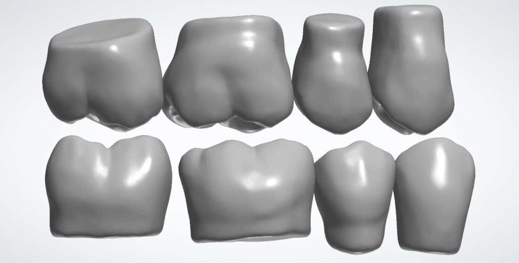 3Shape Dental System - Libraries – 3Shape Design Services