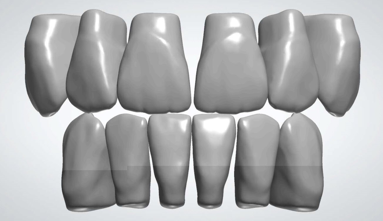 3Shape Dental System - Libraries – 3Shape Design Services