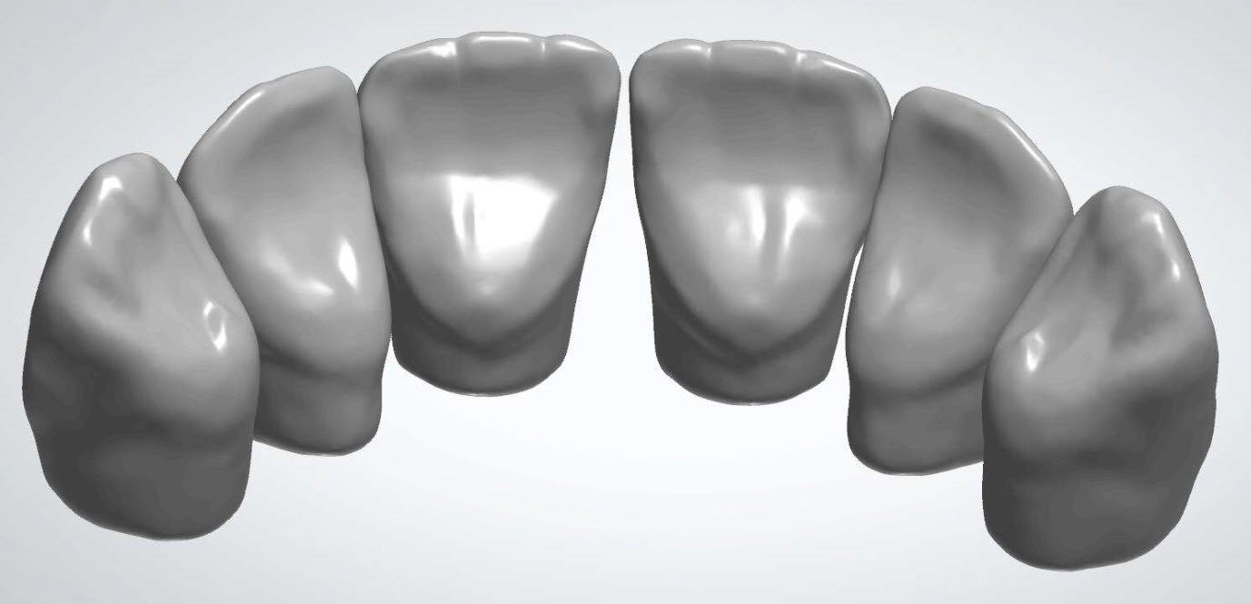 3Shape Dental System - Libraries – 3Shape Design Services