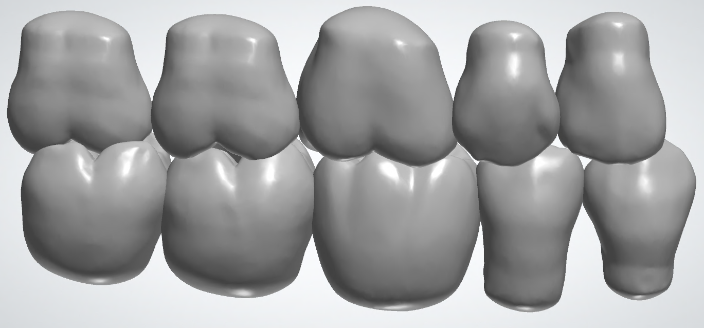 3Shape Dental System - Libraries – 3Shape Design Services