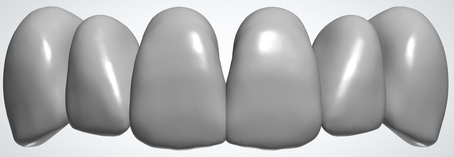 3Shape Dental System - Libraries – 3Shape Design Services
