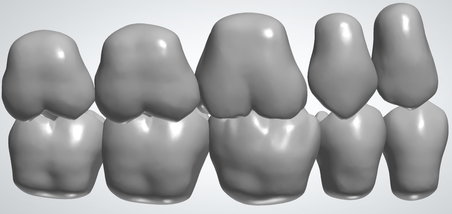 3Shape Dental System - Libraries – 3Shape Design Services