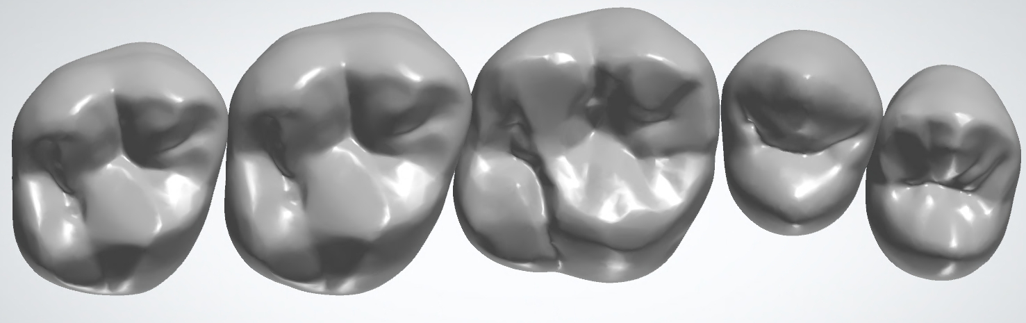 3Shape Dental System - Libraries – 3Shape Design Services