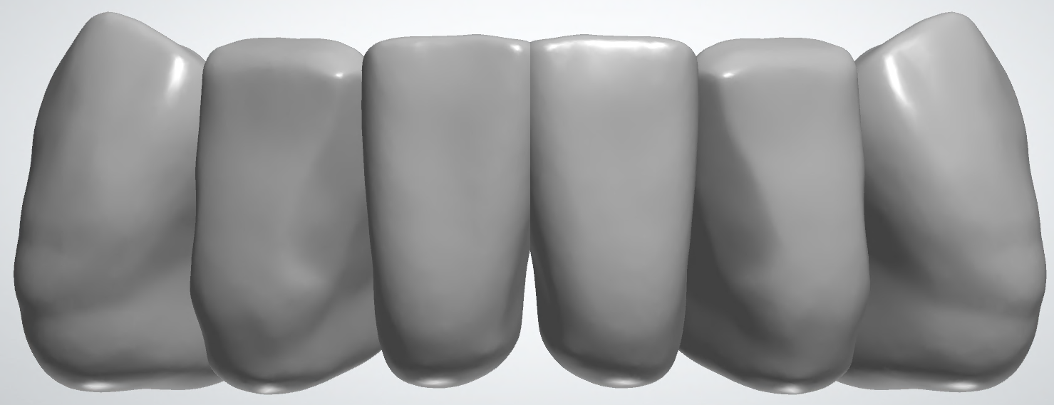 3Shape Dental System - Libraries – 3Shape Design Services