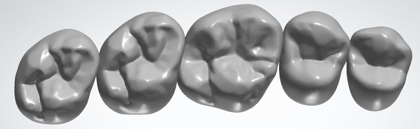 3Shape Dental System - Libraries – 3Shape Design Services