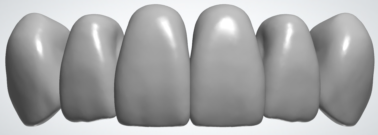 3Shape Dental System - Libraries – 3Shape Design Services