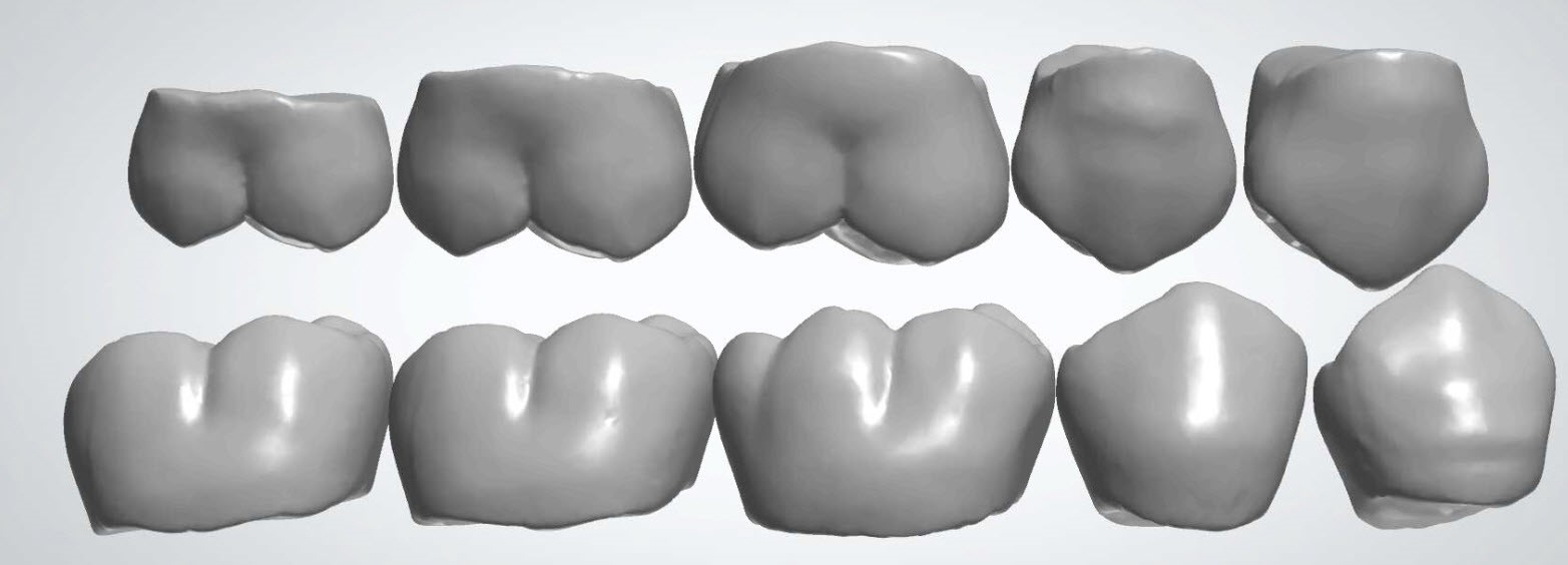 3Shape Dental System - Libraries – 3Shape Design Services