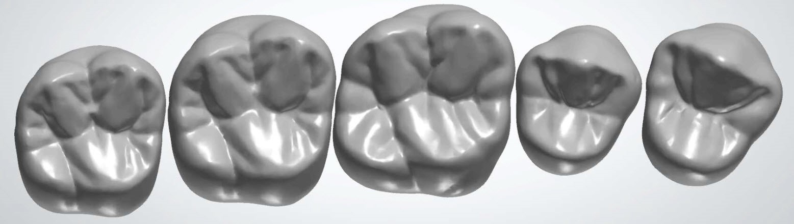 3Shape Dental System - Libraries – 3Shape Design Services