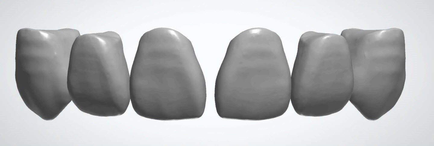 3Shape Dental System - Libraries (External) – 3Shape Design Services