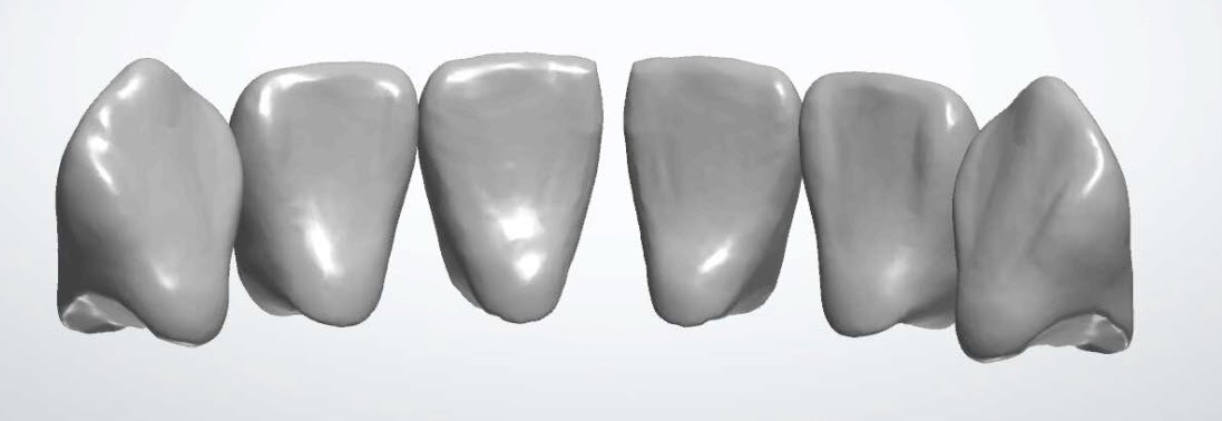 3Shape Dental System - Libraries – 3Shape Design Services