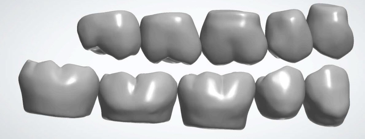 3Shape Dental System - Libraries – 3Shape Design Services