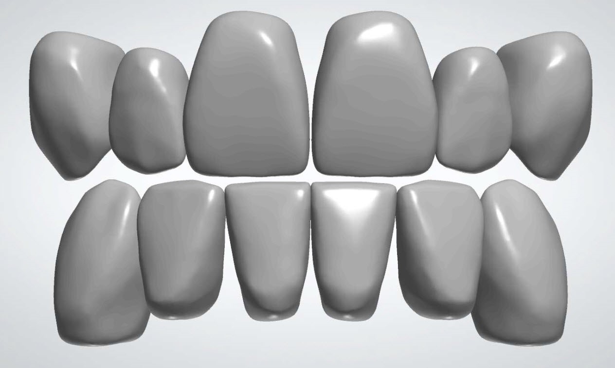 3Shape Dental System - Libraries – 3Shape Design Services