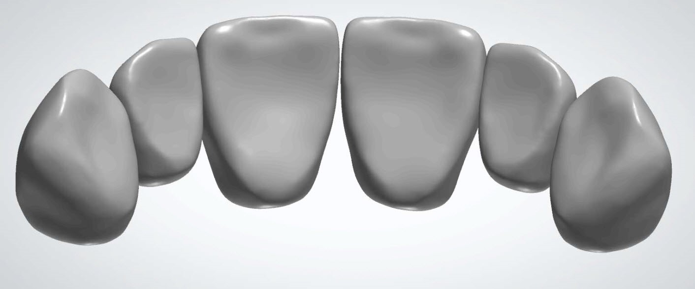 3Shape Dental System - Libraries – 3Shape Design Services