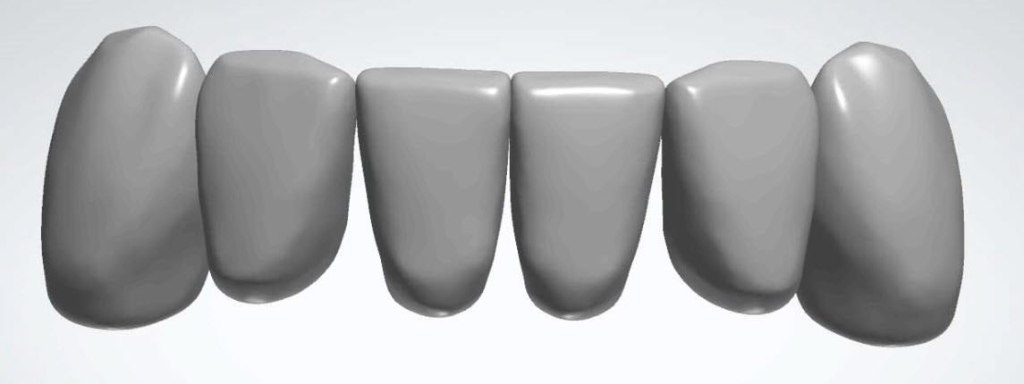 3Shape Dental System - Libraries – 3Shape Design Services