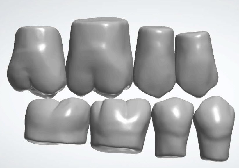 3Shape Dental System - Libraries – 3Shape Design Services