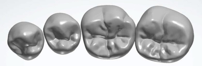 3Shape Dental System - Libraries – 3Shape Design Services