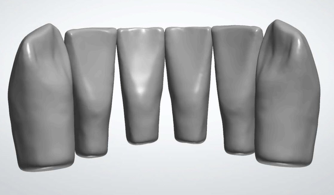 3Shape Dental System - Libraries – 3Shape Design Services