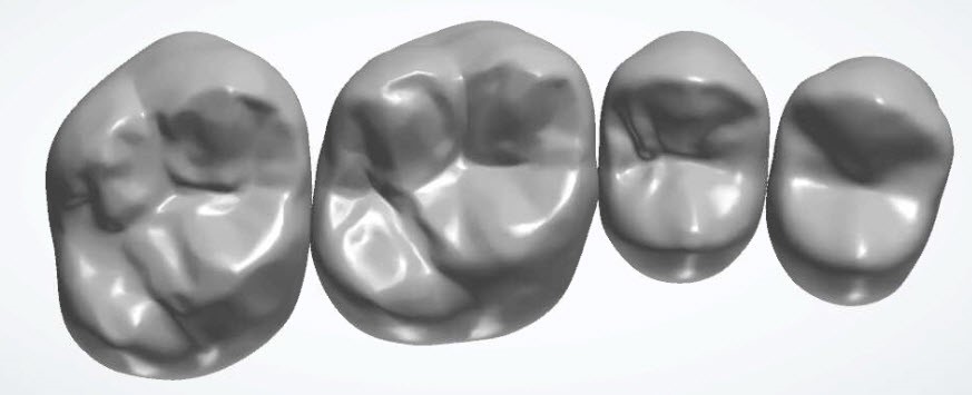3Shape Dental System - Libraries – 3Shape Design Services