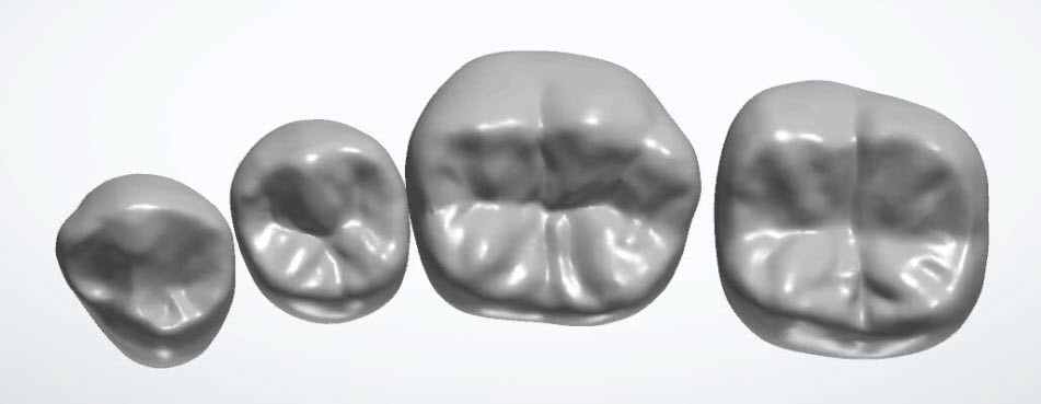 3Shape Dental System - Libraries – 3Shape Design Services