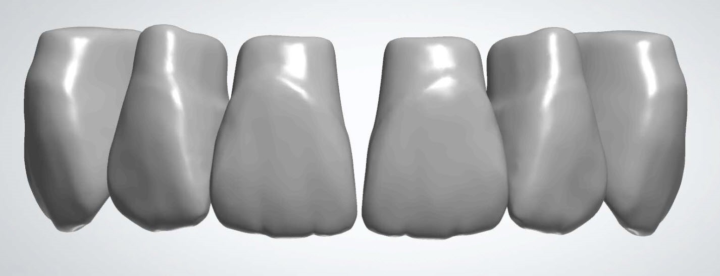 3Shape Dental System - Libraries – 3Shape Design Services