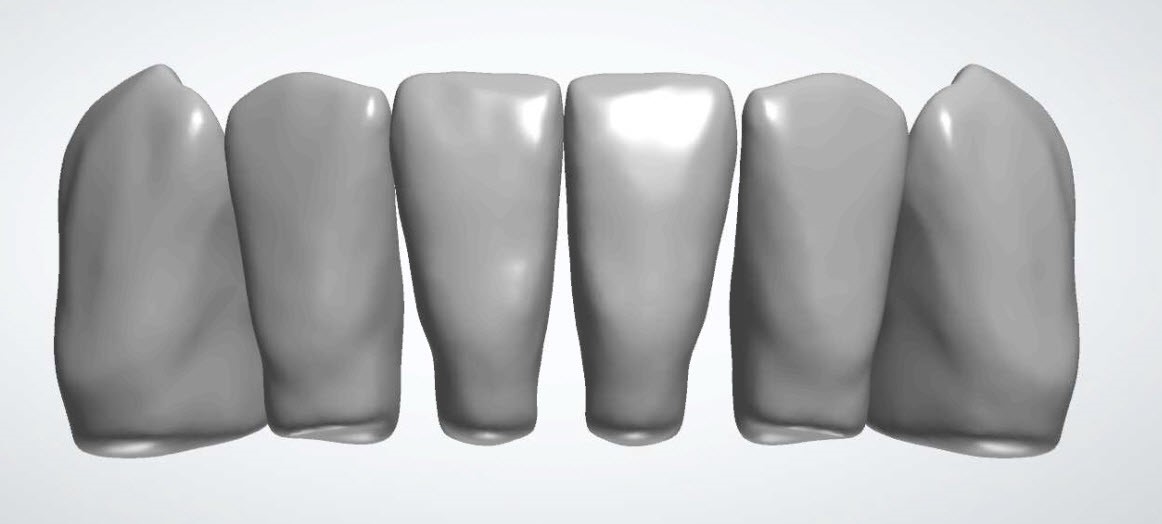 3Shape Dental System - Libraries – 3Shape Design Services