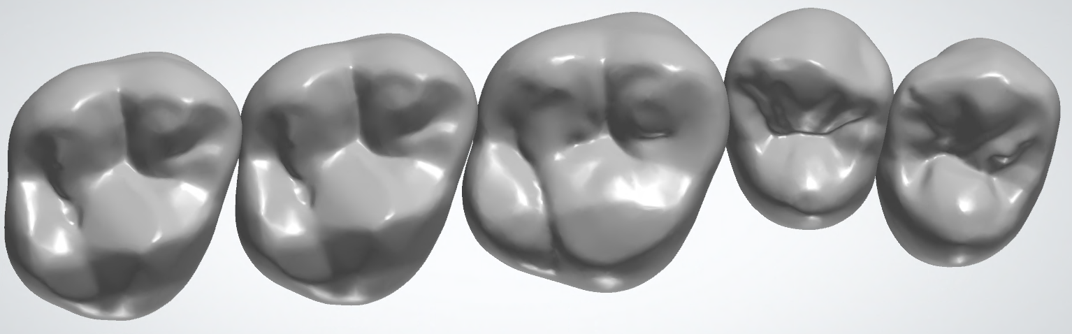 3Shape Dental System - Libraries – 3Shape Design Services