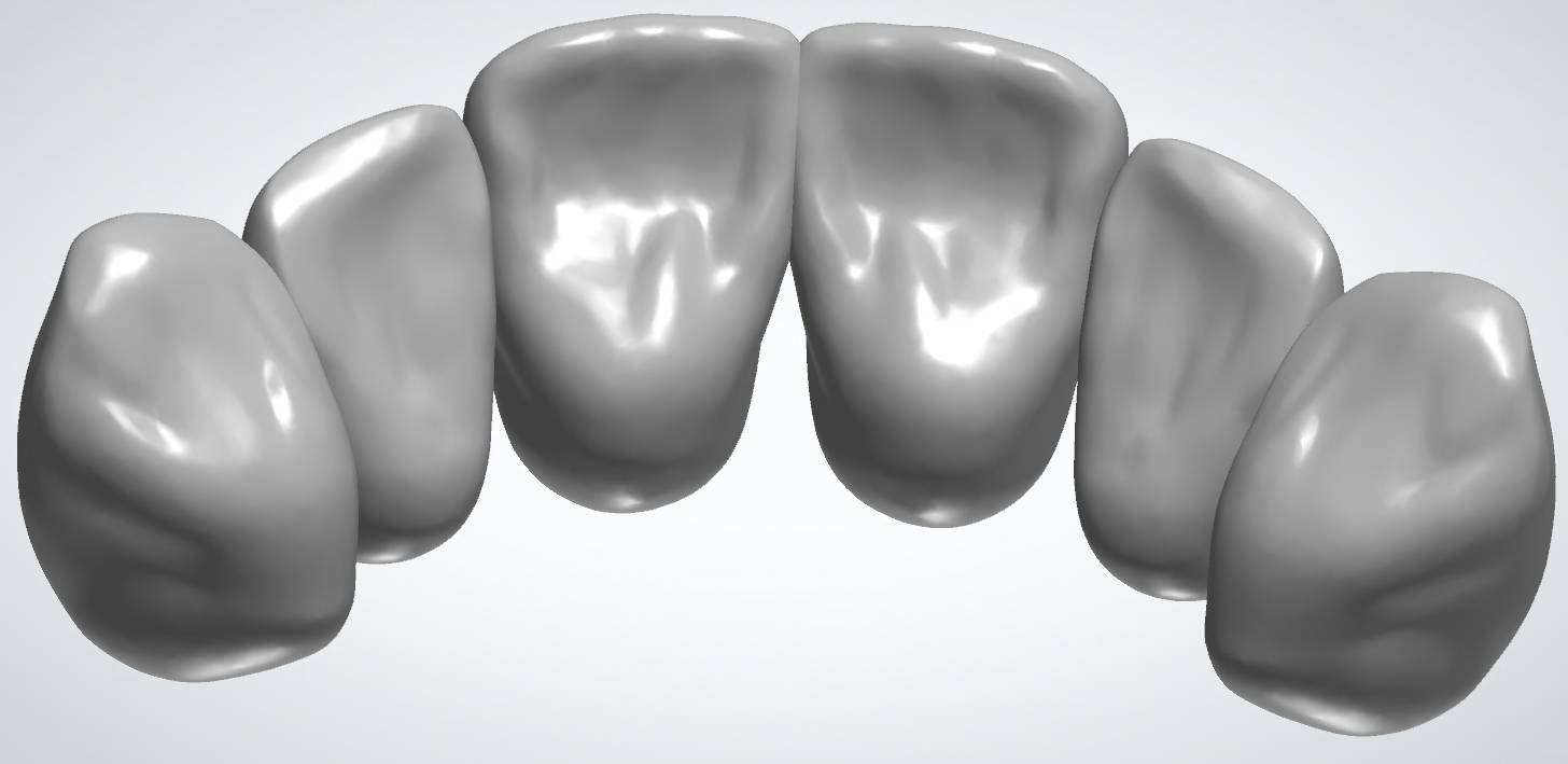 3Shape Dental System - Libraries – 3Shape Design Services
