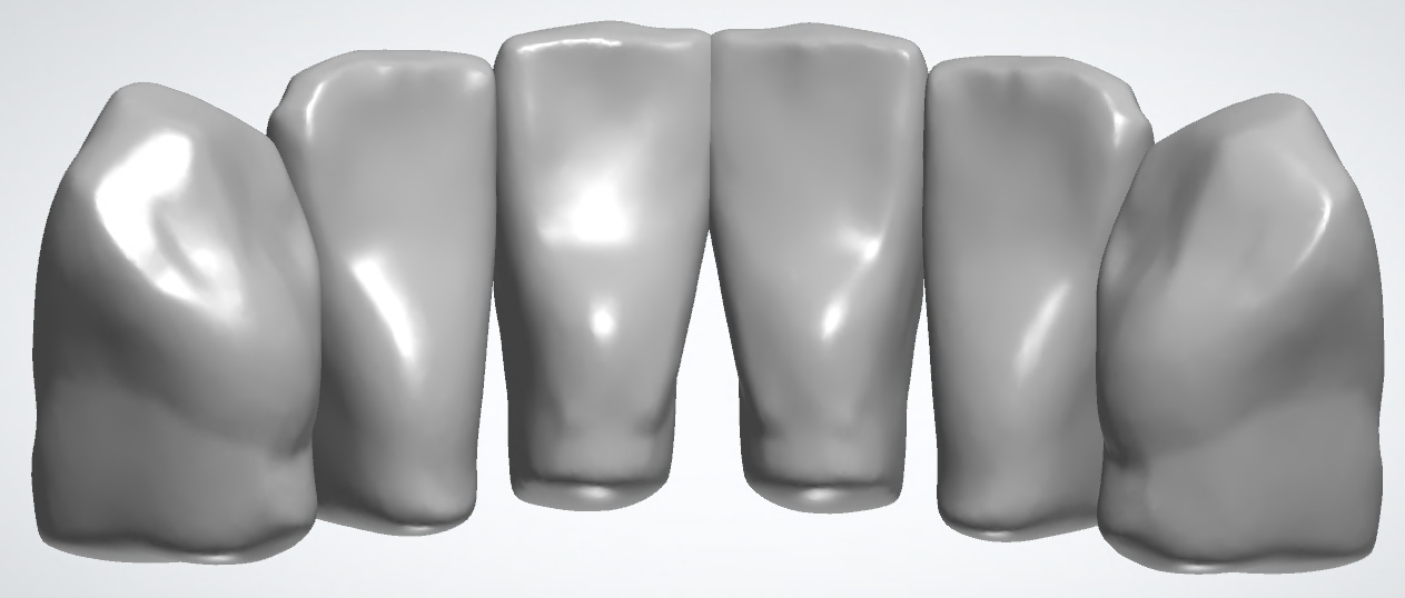 3Shape Dental System - Libraries – 3Shape Design Services
