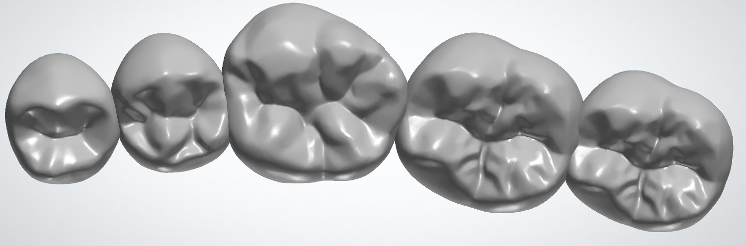 3Shape Dental System - Libraries – 3Shape Design Services