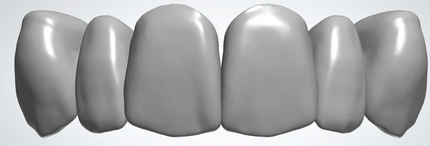 3Shape Dental System - Libraries – 3Shape Design Services