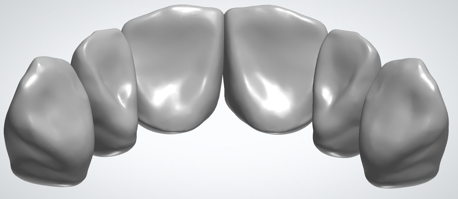 3Shape Dental System - Libraries – 3Shape Design Services