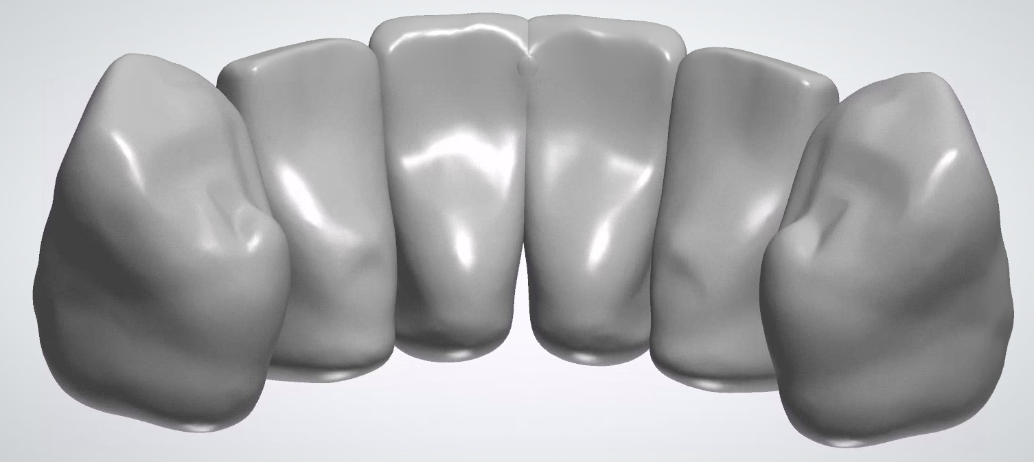 3Shape Dental System - Libraries – 3Shape Design Services