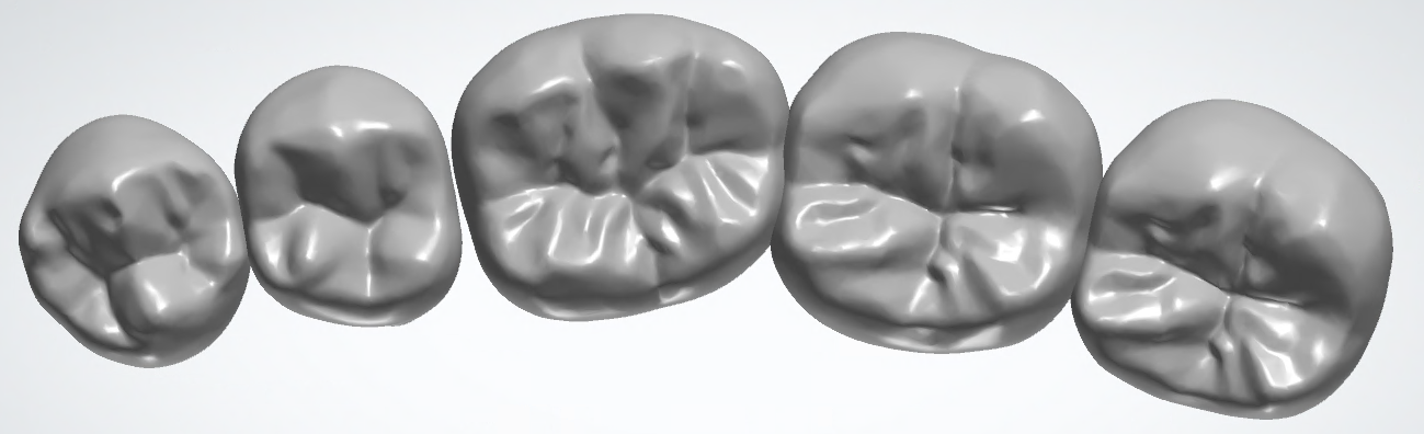 3Shape Dental System - Libraries – 3Shape Design Services