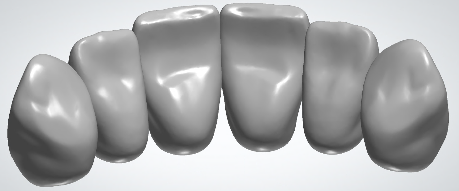 3Shape Dental System - Libraries – 3Shape Design Services