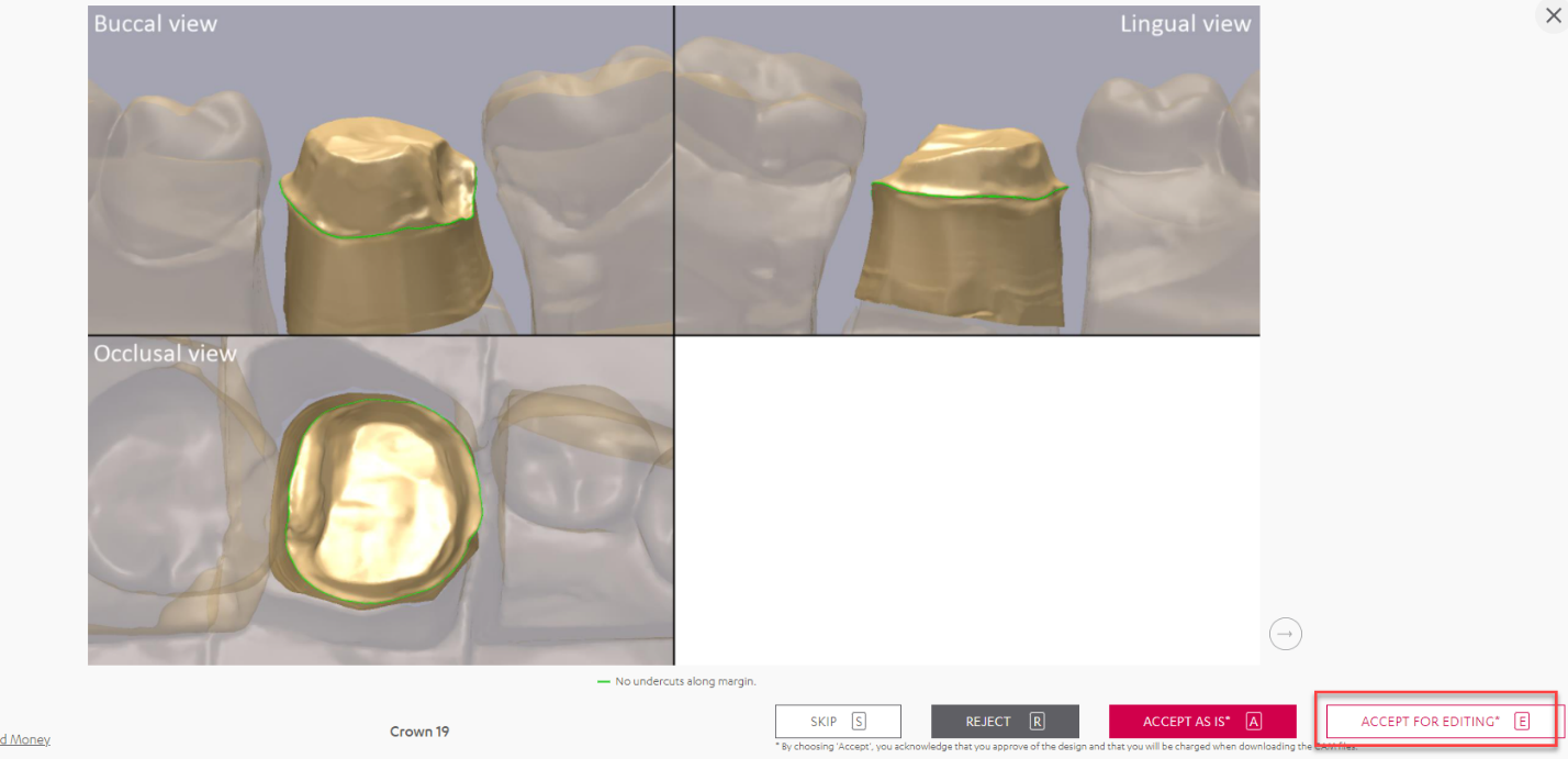 3Shape Automate - How to Upload, Download & Edit a 3Shape Automate ...